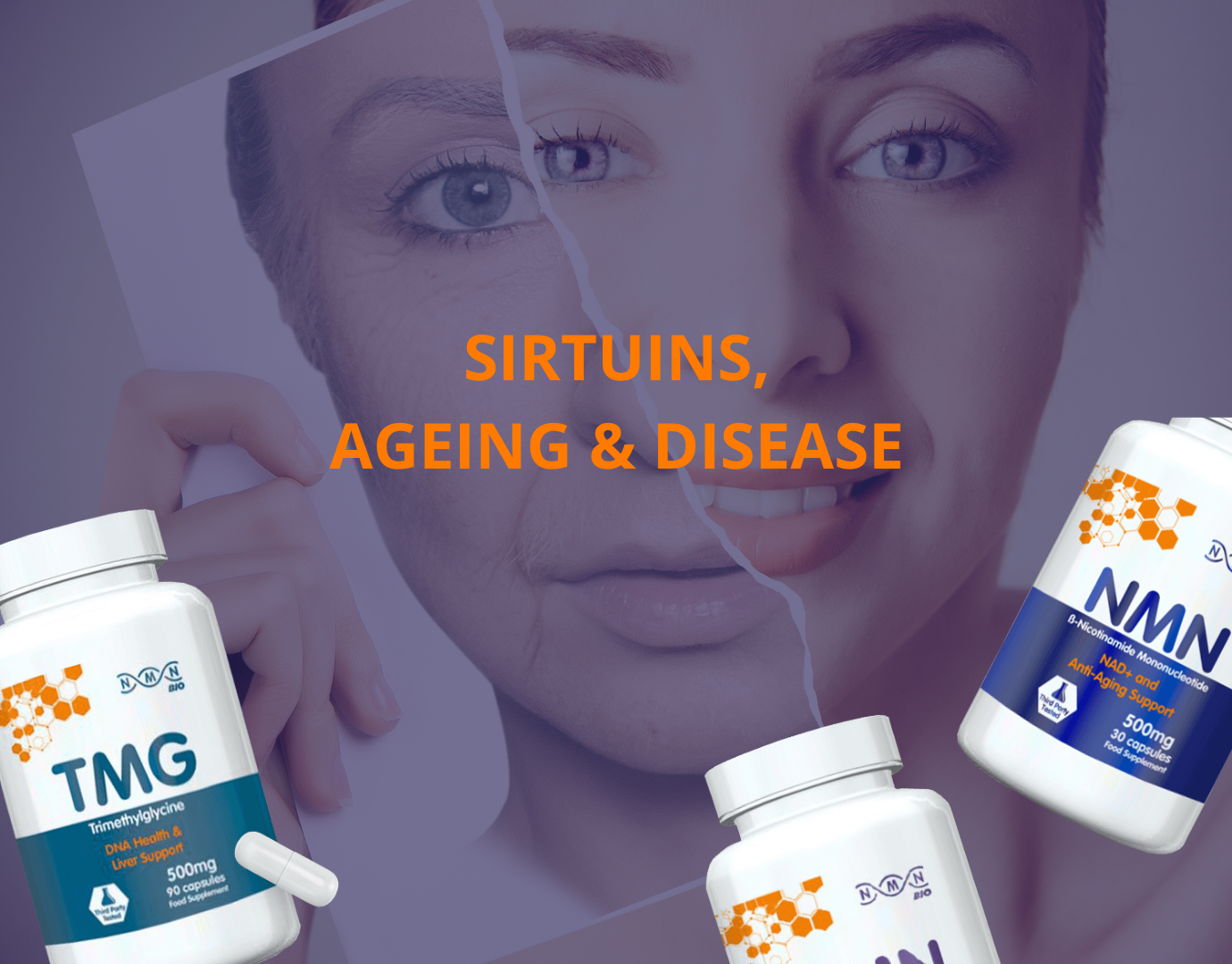 Sirtuins, Sirtuin 2 and Neurodegeneration | NMNBIO